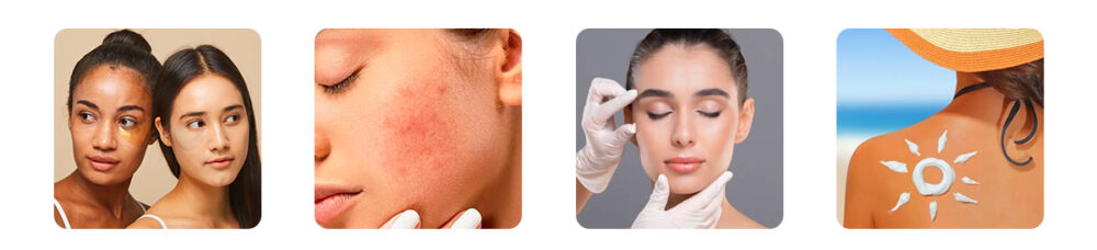 The Complete Guide to Skin Whitening Treatment in India