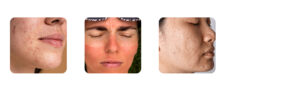 Ultimate Guide to Wheatish Skin: Easy Skincare, Makeup & Tips