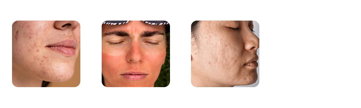 Ultimate Guide to Wheatish Skin: Easy Skincare, Makeup & Tips