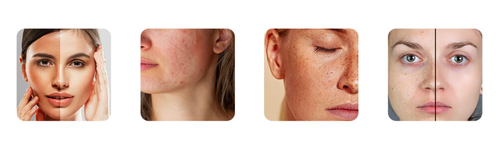Face Bleach Benefits: Everything You Need to Know