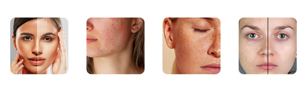 Face Bleach Benefits: Everything You Need to Know