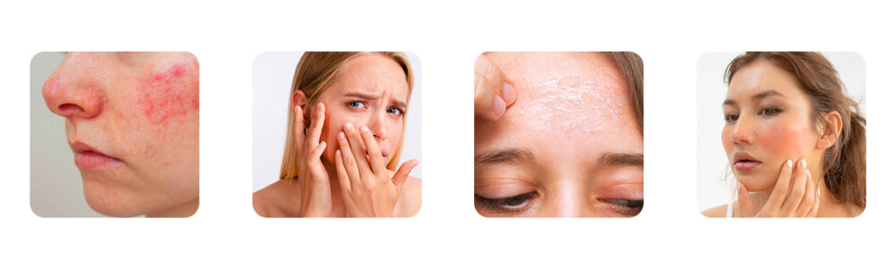 Face Bleach Benefits: Everything You Need to Know